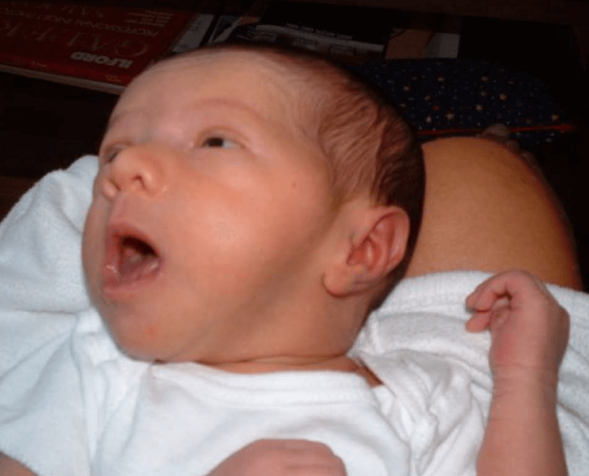 Hunger Cues - MD Pediatric Associates